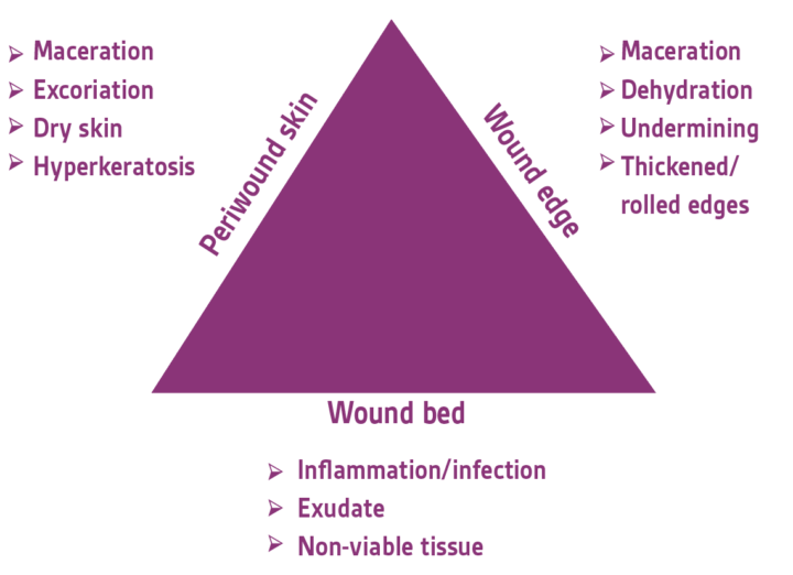 Periwound moisture-associated skin damage: An overview of etiology and ...